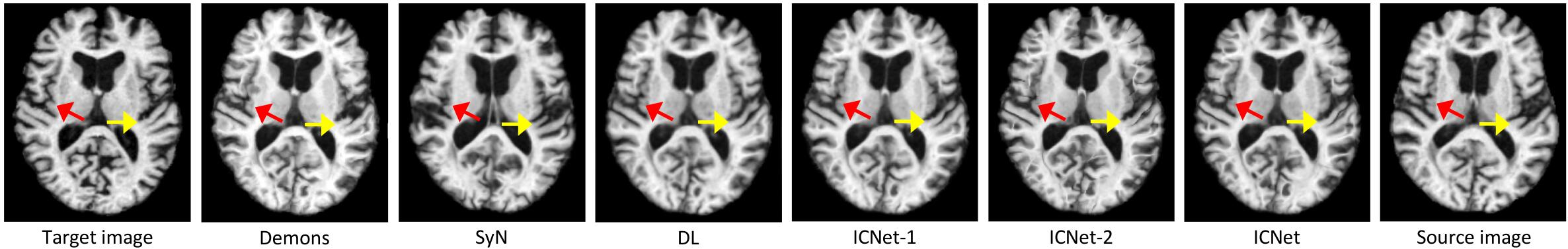 【论文笔记】ICNet：用于无监督医学图像配准的逆一致性模型_inverse-consistent deep networks for unsupervised -CSDN博客