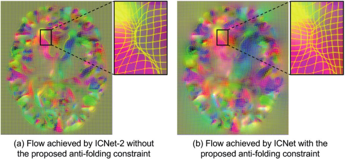 【论文笔记】ICNet：用于无监督医学图像配准的逆一致性模型_inverse-consistent deep networks for unsupervised -CSDN博客