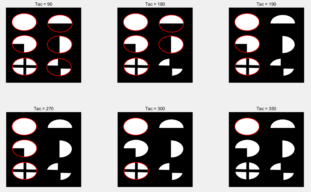 【MATLAB】椭圆检测（Ellipse Detection）算法（含代码）-CSDN博客