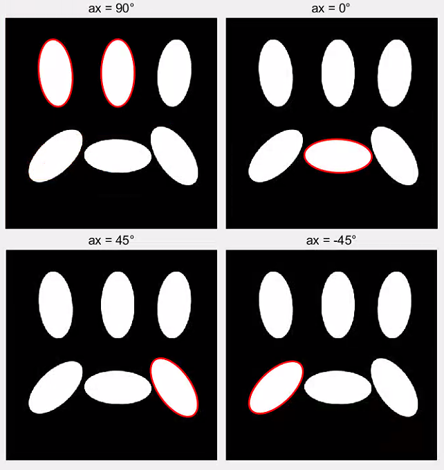 【matlab】椭圆检测（ellipse Detection）算法（含代码） Csdn博客 