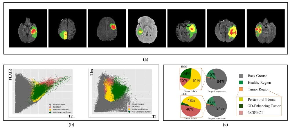 医学分割论文:Deep Learning Based Brain Tumor Segmentation: a survey_deep ...