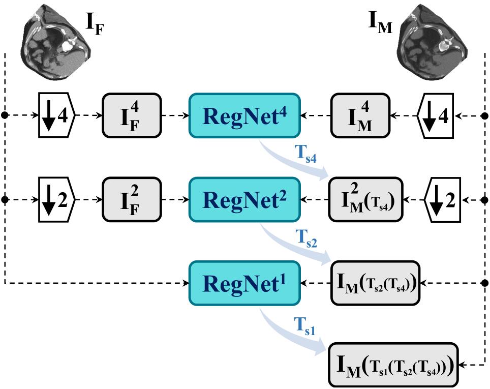 【论文笔记】RegNet：人工合成位移向量场的3D医学图像配准网络_3d配准 频域-CSDN博客