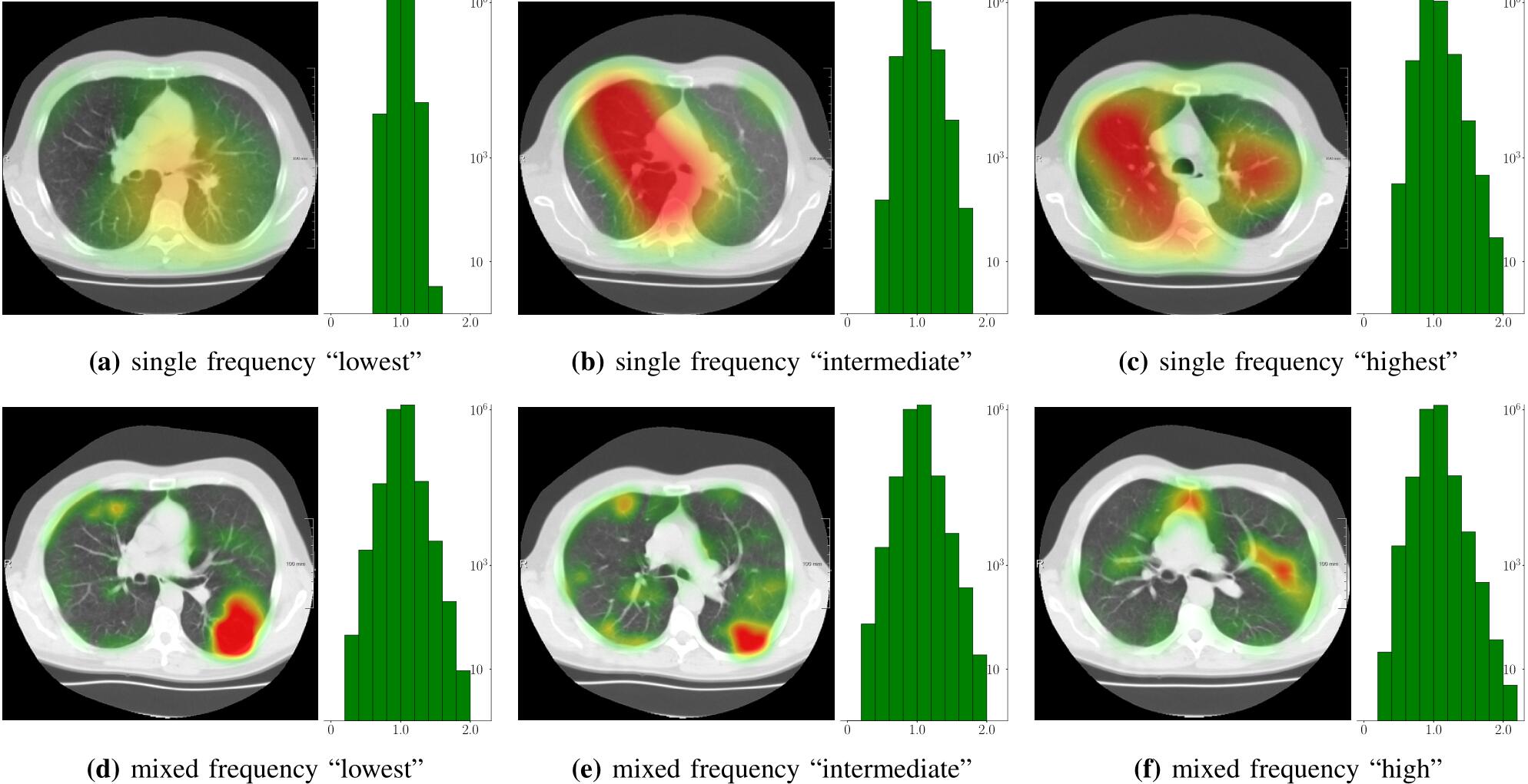 【论文笔记】RegNet：人工合成位移向量场的3D医学图像配准网络_3d配准 频域-CSDN博客
