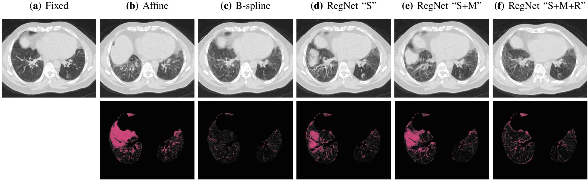 【论文笔记】RegNet：人工合成位移向量场的3D医学图像配准网络_3d配准 频域-CSDN博客