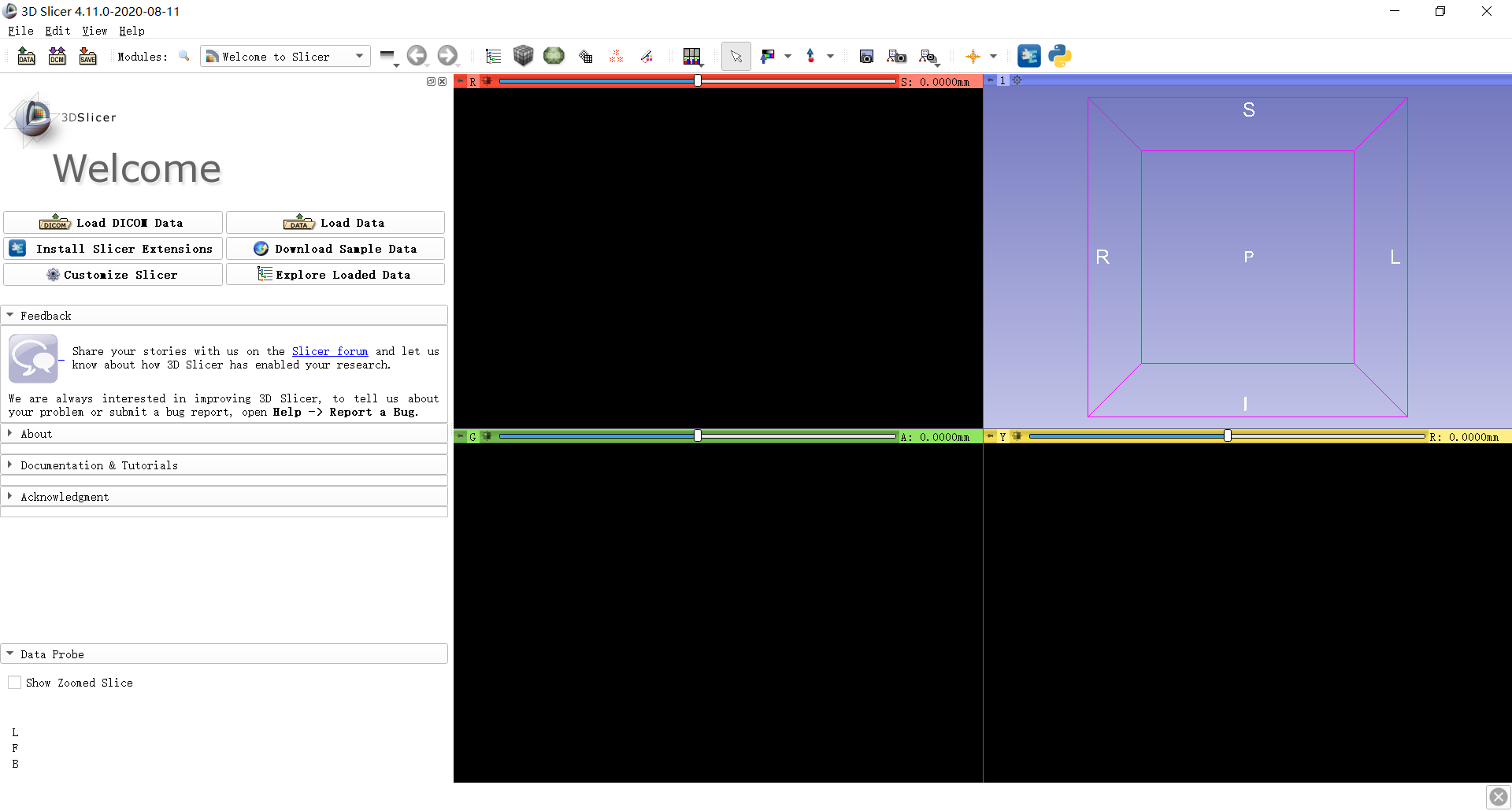 有关编译3d Slicer遇到的一些坑_3d slicer 编译-CSDN博客