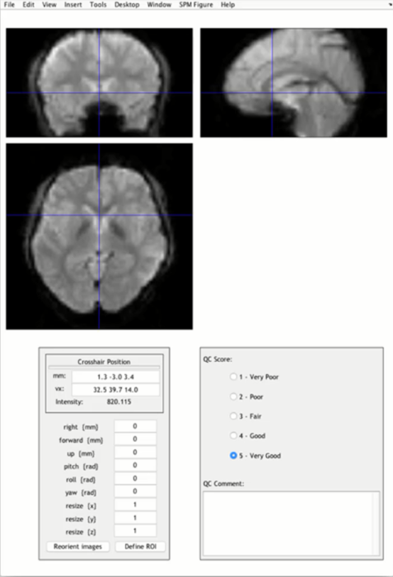 【DPABI教程】DPARSF详细教程笔记-CSDN博客