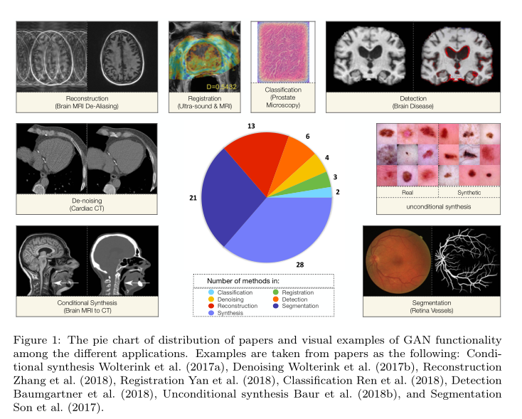 [Style Transfer]——GANs for Medical Image Analysis_gan,medical image ...