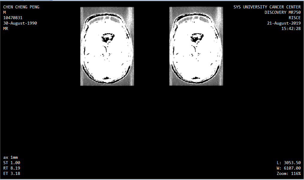 基于ITK的读并写 2D的DICOM 图像_c# 使用itk保存dicom文件-CSDN博客