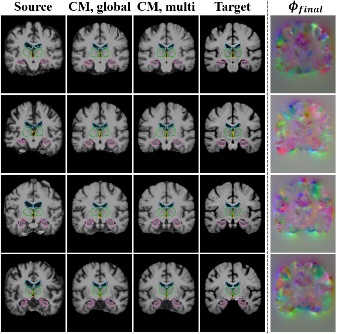 【论文笔记】CycleMorph：使用循环一致性的2D/3D/多尺度微分同胚图像配准模型_cyclemorph: cycle consistent unsupervised deformab ...