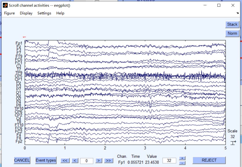 利用eeglab处理采集的脑电信号_脑电vhdr格式-CSDN博客