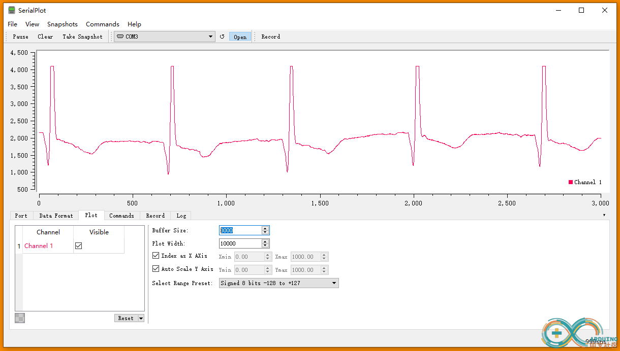 实测可用 】ESP32 + AD8232 心电图实验_ad8232 arduino-CSDN博客