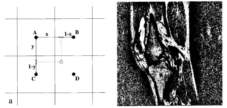 《Contrast Limited Adaptive Histogram Equalization》自译-CSDN博客