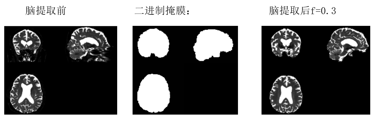 FSL处理DTI数据详细流程-CSDN博客