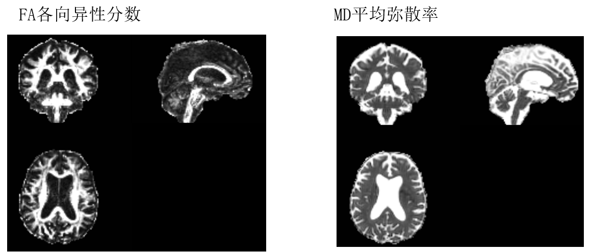 FSL处理DTI数据详细流程_水木自亲的博客-CSDN博客