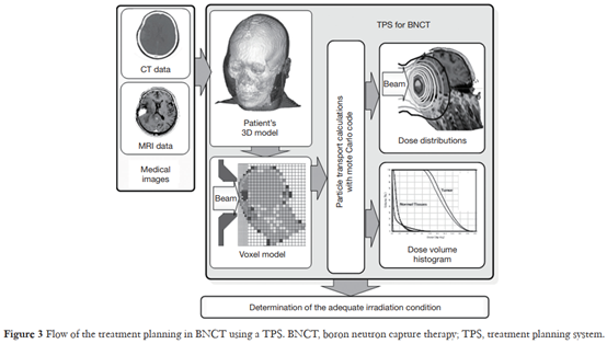 【Reference reading】硼中子俘获治疗计划及患者定位_thorplan治疗计划系统-CSDN博客