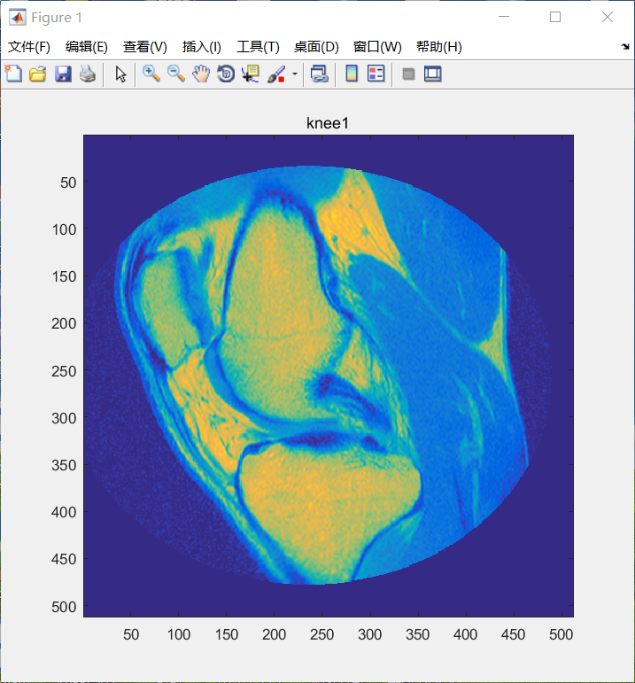 MATLAB对CT图读取，写入_matlab中的ct值读取函数-CSDN博客