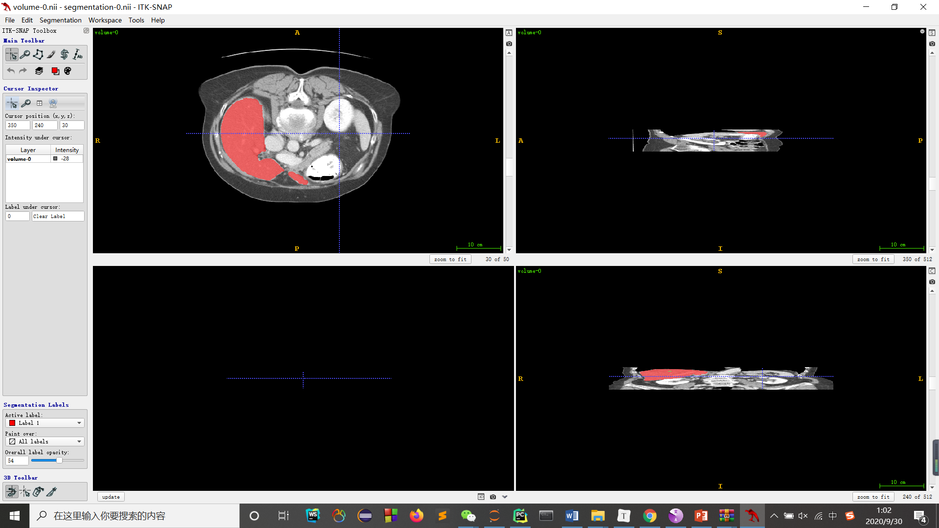 医学图像——数据读取和预处理（含代码）_nii和nrrd文件处理为dataset-CSDN博客