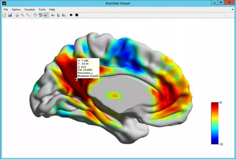BrainNet Viewer:人类大脑连接的网络可视化工具_aal图谱-CSDN博客
