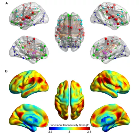 BrainNet Viewer:人类大脑连接的网络可视化工具_aal图谱-CSDN博客