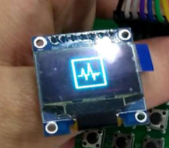 基于STM32F4的可穿戴式智能手表原型设计_基于stm32老人健康监测智能手表-CSDN博客