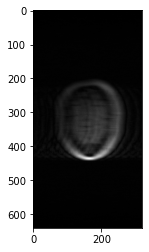 fastMRI 数据读取参考代码_matlab读取fastmri-CSDN博客