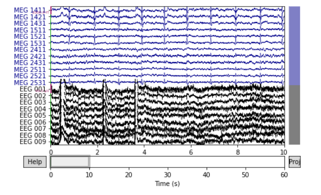 MNE学习笔记3_mne load .dat_LiDLMU的博客-CSDN博客
