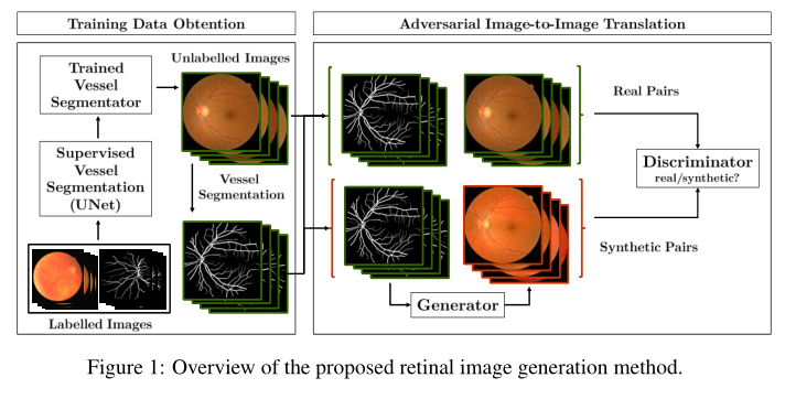 论文阅读——Towards Adversarial Retinal Image Synthesis_end-to-end adversarial retinal image synthesis ...