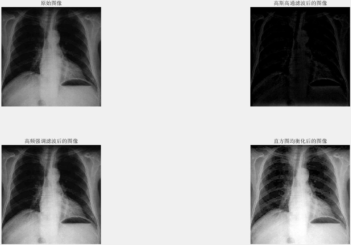 Matlab high-frequency emphasis filter enhancement, Gaussian high-pass filter, Butterworth high ...