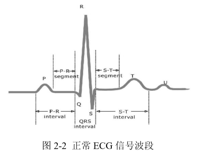心电信号求qrs点坐标_2020年江苏省电子设计竞赛心电监测-CSDN博客