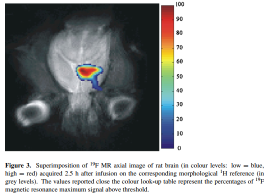 【Reference reading】用19F标记的BPA-果糖复合物在C6老鼠胶质瘤模型的19F MRI和19F MRS来优化硼中子捕获治疗 ...
