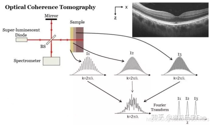 时域OCT与频域OCT的区别-CSDN博客