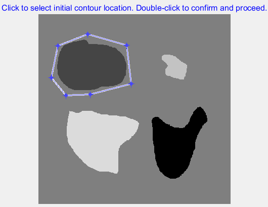 Matlab图像分割---使用主动轮廓 (snake) 方法进行图像分割_snake算法图像分割-CSDN博客