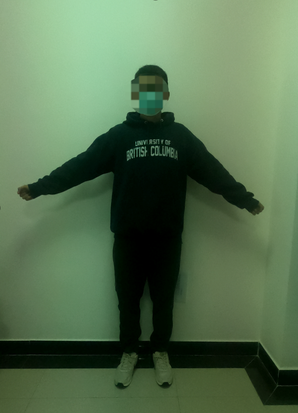 Python-数字图像处理-直方图均衡/对比度/亮度/色调/曝光/滤波/自动gamma校正/MSRCR_计算图片亮度,直方图,对比度,返回最合适曝光值python-CSDN博客