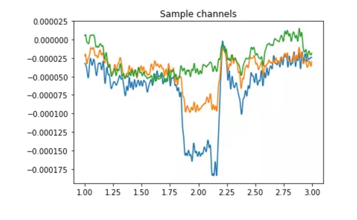 脑机接口基础学习08----读取.edf文件_qt中怎么打开edf文件-CSDN博客