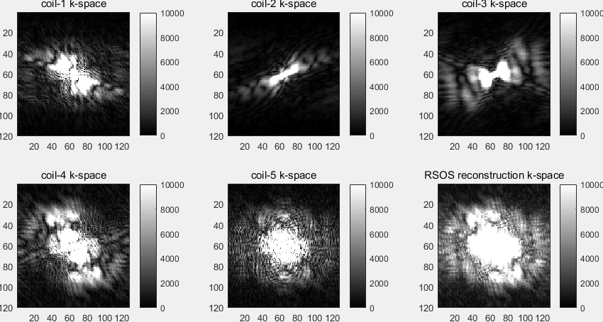 【MRI】SENSE (Sensitivity Encoding) 算法 仿真实验与原理剖析 (Matlab 实现)_down sampling rate-CSDN博客