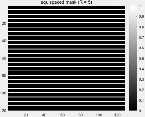 【MRI】SENSE (Sensitivity Encoding) 算法 仿真实验与原理剖析 (Matlab 实现)_down ...