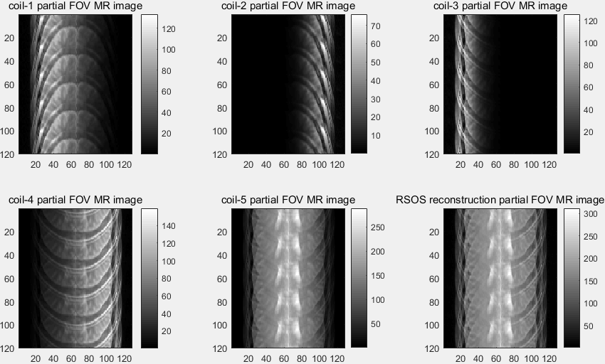【MRI】SENSE (Sensitivity Encoding) 算法 仿真实验与原理剖析 (Matlab 实现)_down sampling rate-CSDN博客