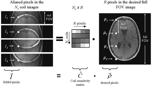 【MRI】SENSE (Sensitivity Encoding) 算法 仿真实验与原理剖析 (Matlab 实现)_down ...
