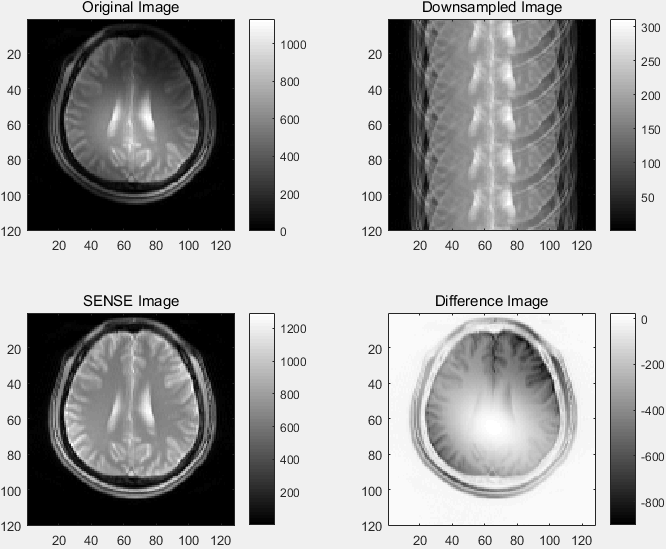 【MRI】SENSE (Sensitivity Encoding) 算法 仿真实验与原理剖析 (Matlab 实现)_down sampling rate-CSDN博客