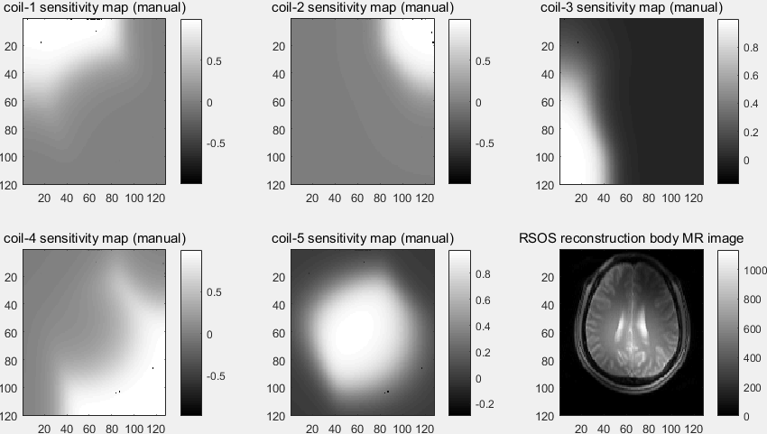 【MRI】SENSE (Sensitivity Encoding) 算法 仿真实验与原理剖析 (Matlab 实现)_down sampling rate-CSDN博客