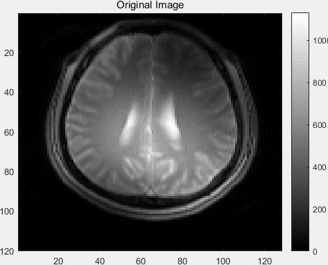 【MRI】GRAPPA (GeneRalized Autocalibrating Partially Parallel Acquisitions) 算法 仿真实验与原理剖析 (Matlab ...