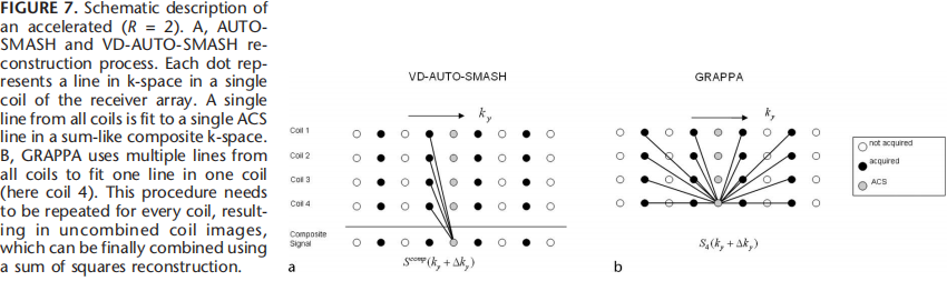 【MRI】GRAPPA (GeneRalized Autocalibrating Partially Parallel ...