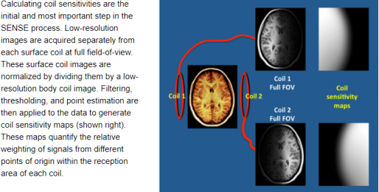 【MRI】SENSE (Sensitivity Encoding) 算法 仿真实验与原理剖析 (Matlab 实现)_down sampling rate-CSDN博客