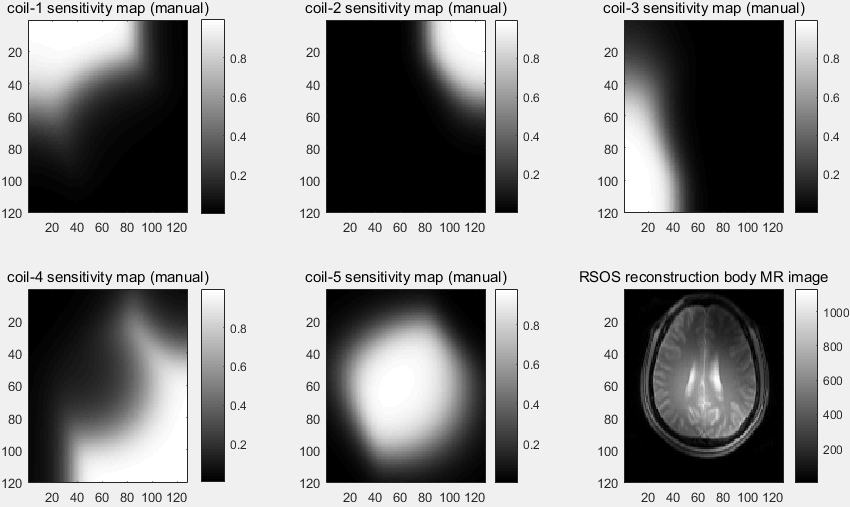 【MRI】SENSE (Sensitivity Encoding) 算法 仿真实验与原理剖析 (Matlab 实现)_down sampling rate-CSDN博客