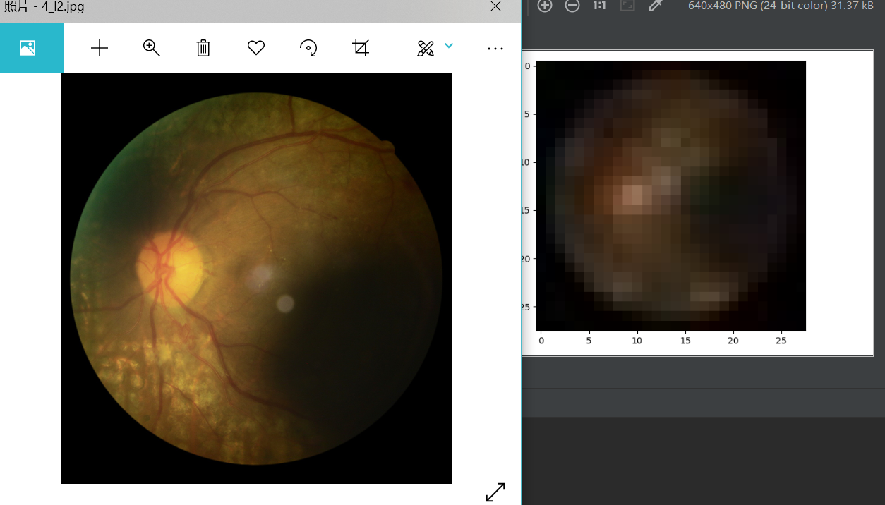 MedMNIST：医学领域中的MNIST数据集-CSDN博客