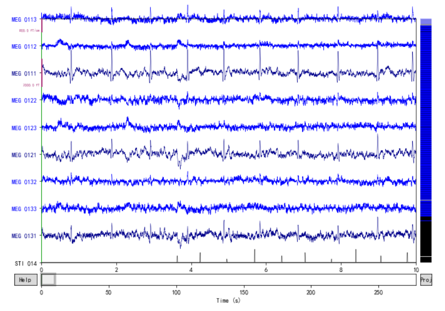 脑机接口基础学习16---脑电数据Epoching处理_脑电图中 epoch怎么翻译-CSDN博客