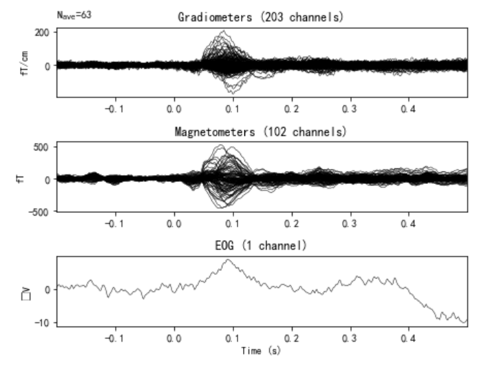 脑机接口基础学习16---脑电数据Epoching处理_脑电图中 epoch怎么翻译-CSDN博客
