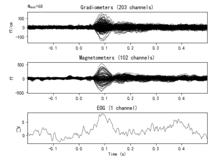 脑机接口基础学习16---脑电数据Epoching处理_脑电图中 epoch怎么翻译-CSDN博客