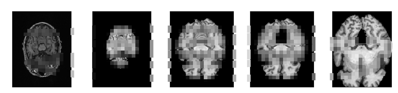 DTI及MRI数据预处理_dti的mask怎么做-CSDN博客