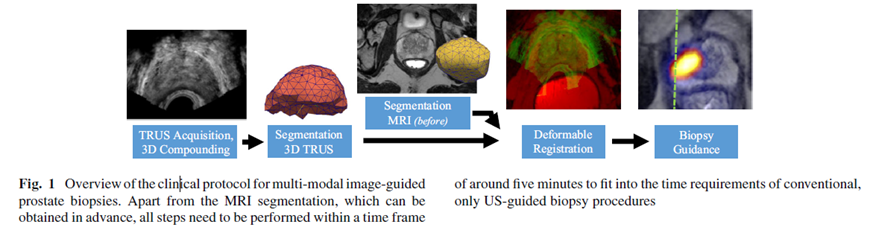 【医学影像】超声（UltraSound）影像与 CT/MRI 多模态融合配准_超声图像配准-CSDN博客